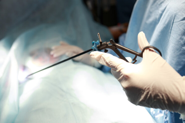 Laparoscopy: a minimally invasive intervention to examine a uterine ...